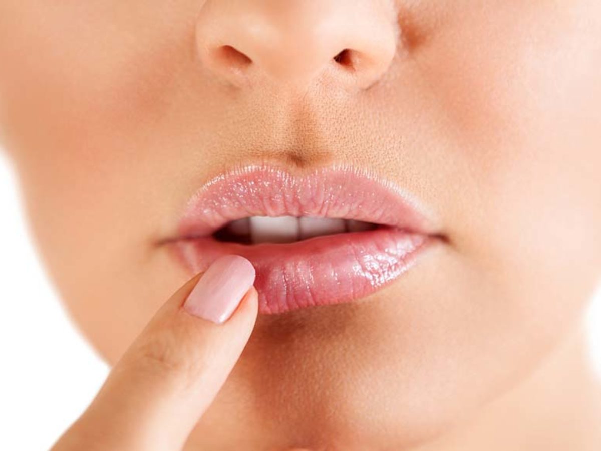 ¿Qué es el herpes labial? Causas y tratamientos - Clínica Garden